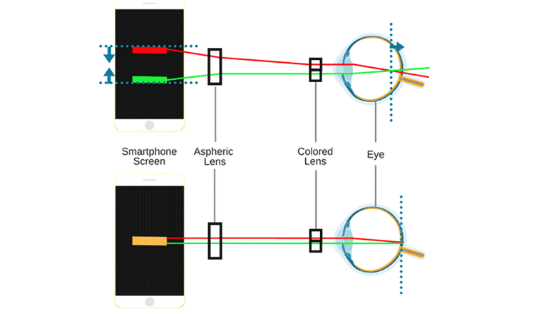 スマートフォンによる視力検査・視力矯正を可能とした取り付け型検査システム「EyeQue VisionCheck 2」 - Foresight & Insight